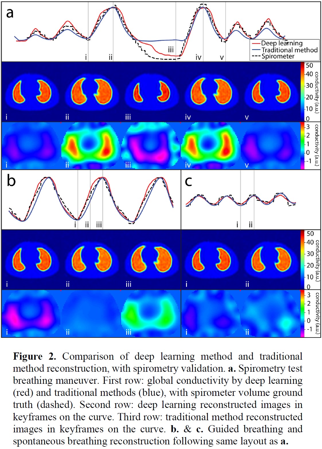 Deep learning based reconstruction enables high-resolution electrical impedance tomography for ...