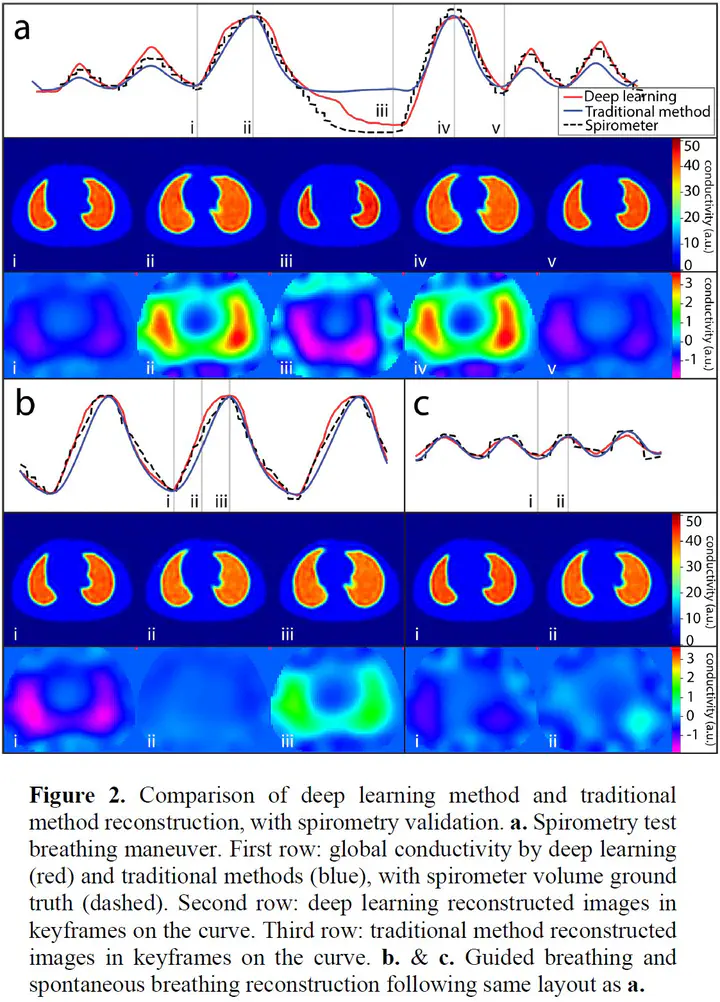 Deep learning based reconstruction enables high-resolution electrical ...
